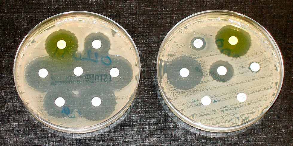 Candida auris, fungo super-resistente: alerta risco de morte - greenMe