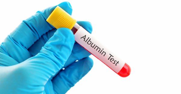 Albumina alta e baixa. O que causa e como corrigir - greenMe