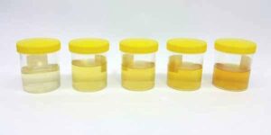 O Que a Cor da Urina Revela Sobre Sua Saúde? - greenMe