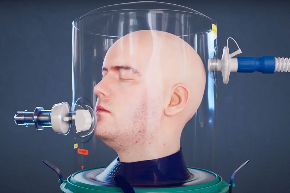 Elmo, um capacete de respiração assistida para evitar a intubação por ...