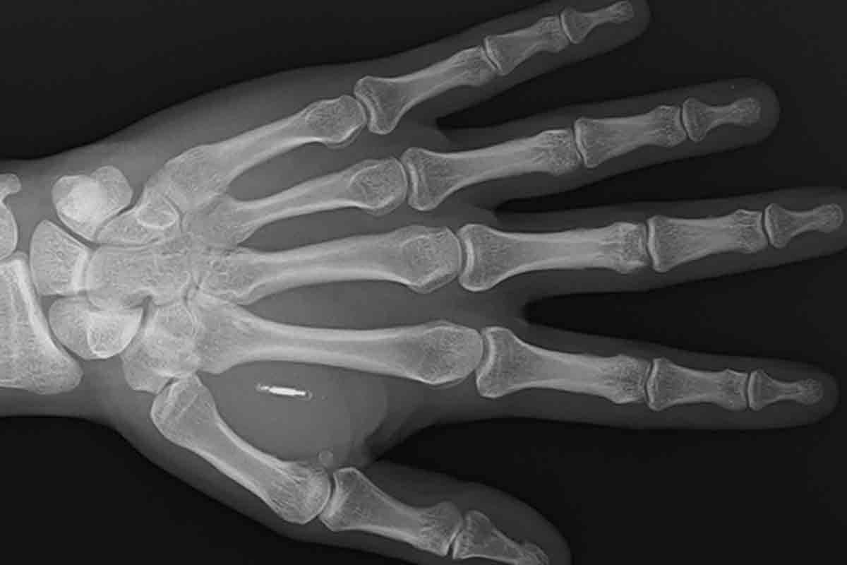 Microchip para fazer pagamento: qual o preço dessa conveniência? - greenMe